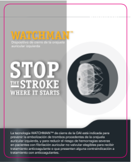 Recursos de WATCHMAN: para los médicos - Dispositivo Watchman